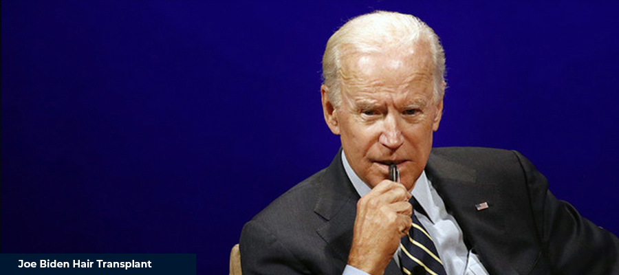 Joe Biden Hair Transplant - Smile Hair Clinic Joe Biden Hair Transplant - Smile Hair Clinic