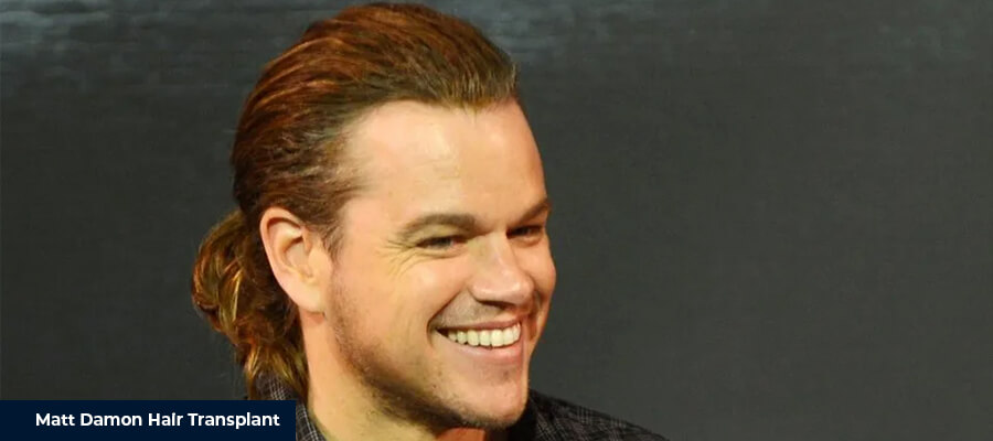 Matt Damon Hair Transplant | Smile Hair Clinic