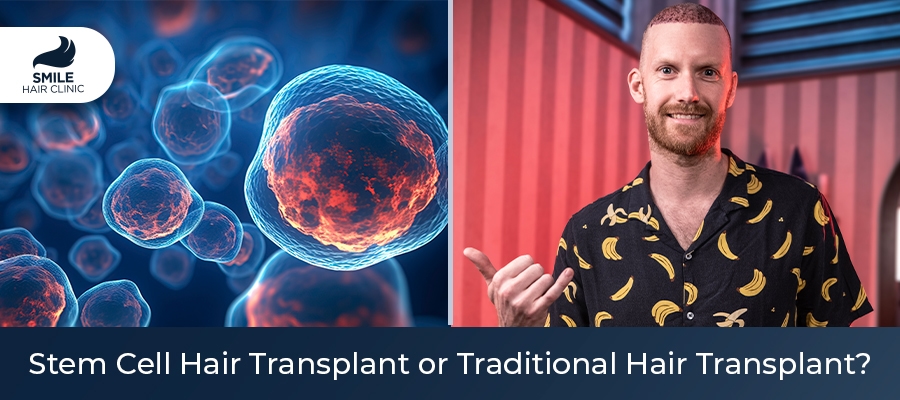 Stem Cell Hair Transplant or Traditional Hair Transplant? - Smile Hair ...