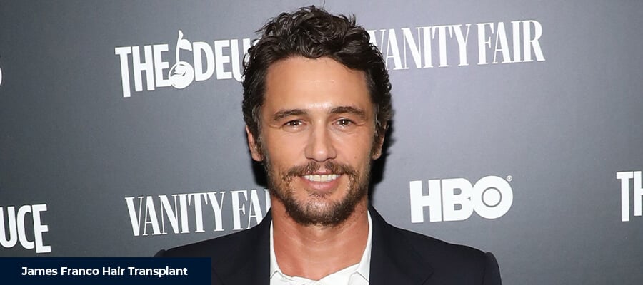 James Franco hårtransplantation | Smile Hair Clinic