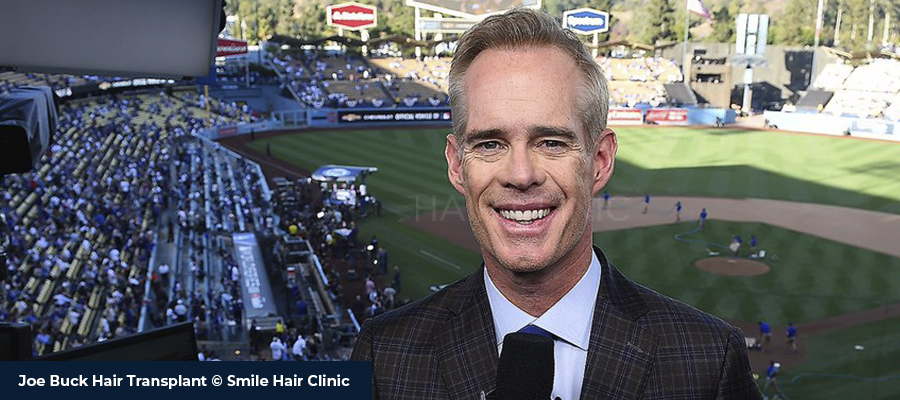Trasplante de cabello de Joe Buck - Smile Hair Clinic