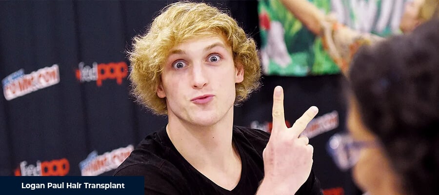 Trapianto di capelli Logan Paul | Smile Hair Clinic