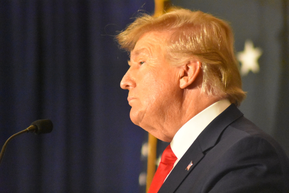 Trump Hair Transplant: Donald Trump Hair Surgery, Scalp Reduction ...