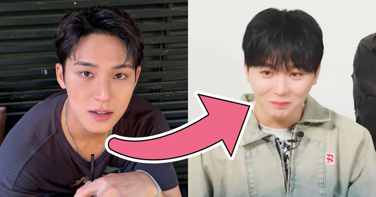 Mingyu Hair Transplant: Before & After Hairline Analysis | Smile Hair ...
